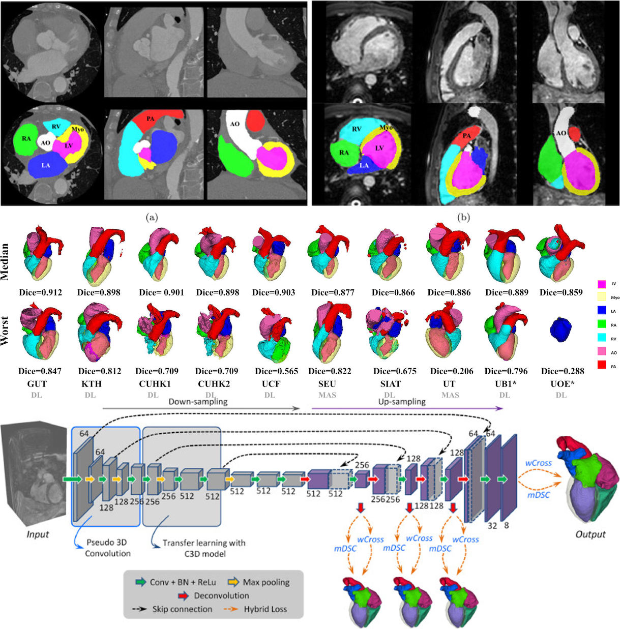 Evaluation Of Algorithms For Multi Modality Whole Heart Segmentation An Open Access Grand Challenge
