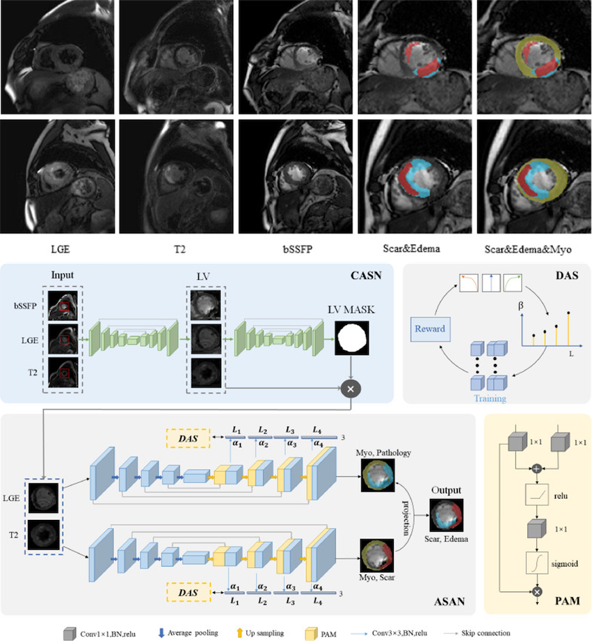 AWSnet: An Auto-weighted Supervision Attention Network for Myocardial Scar and Edema ...