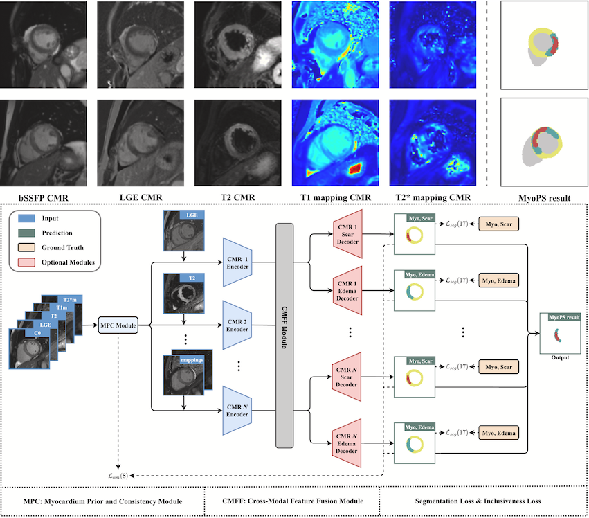 MyoPS-Net: Myocardial Pathology Segmentation with Flexible Combination of Multi-Sequence CMR Images