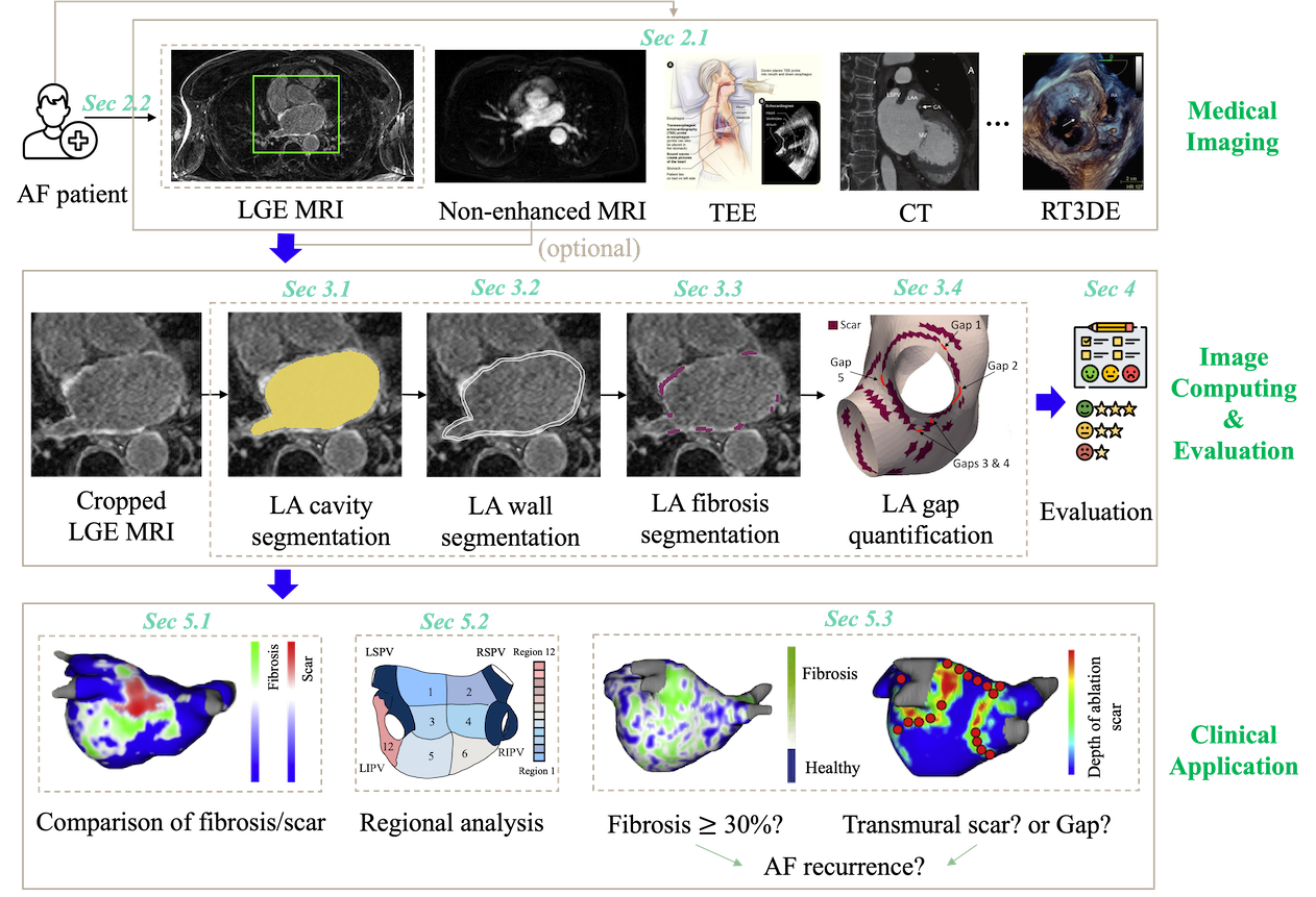 Medical Image Analysis on Left Atrial LGE MRI for Atrial Fibrillation Studies: A Review