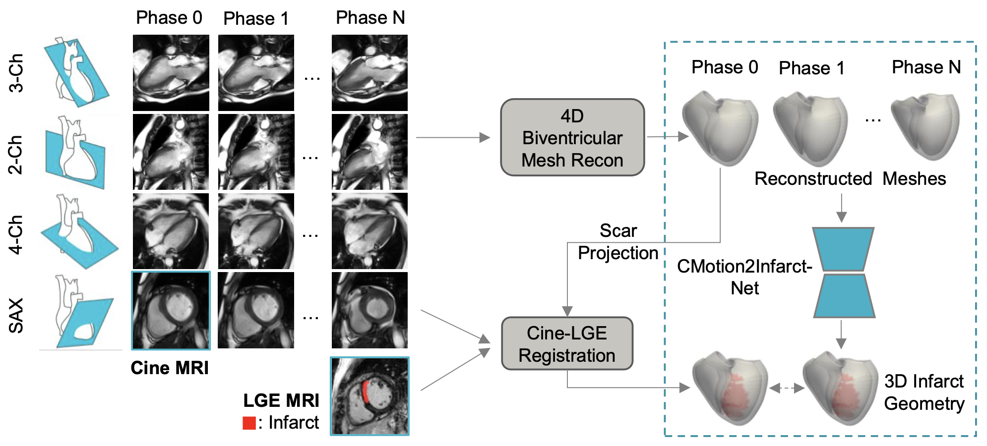 Personalized 3D Myocardial Infarct Geometry Reconstruction from Cine ...
